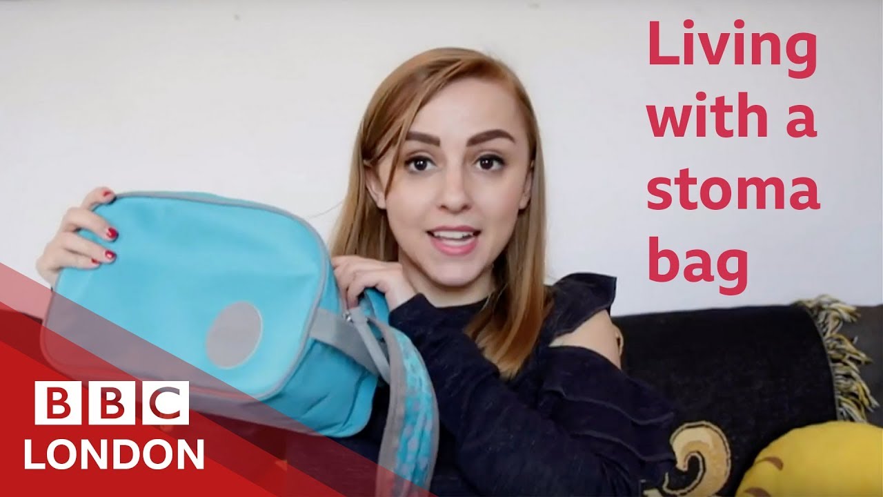 Living With A Stoma Bag Feat Hanna Witton Bbc London Youtube