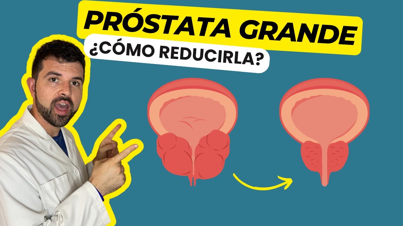 Prostata Grande Descubre Cómo Reducir La Próstata Youtube