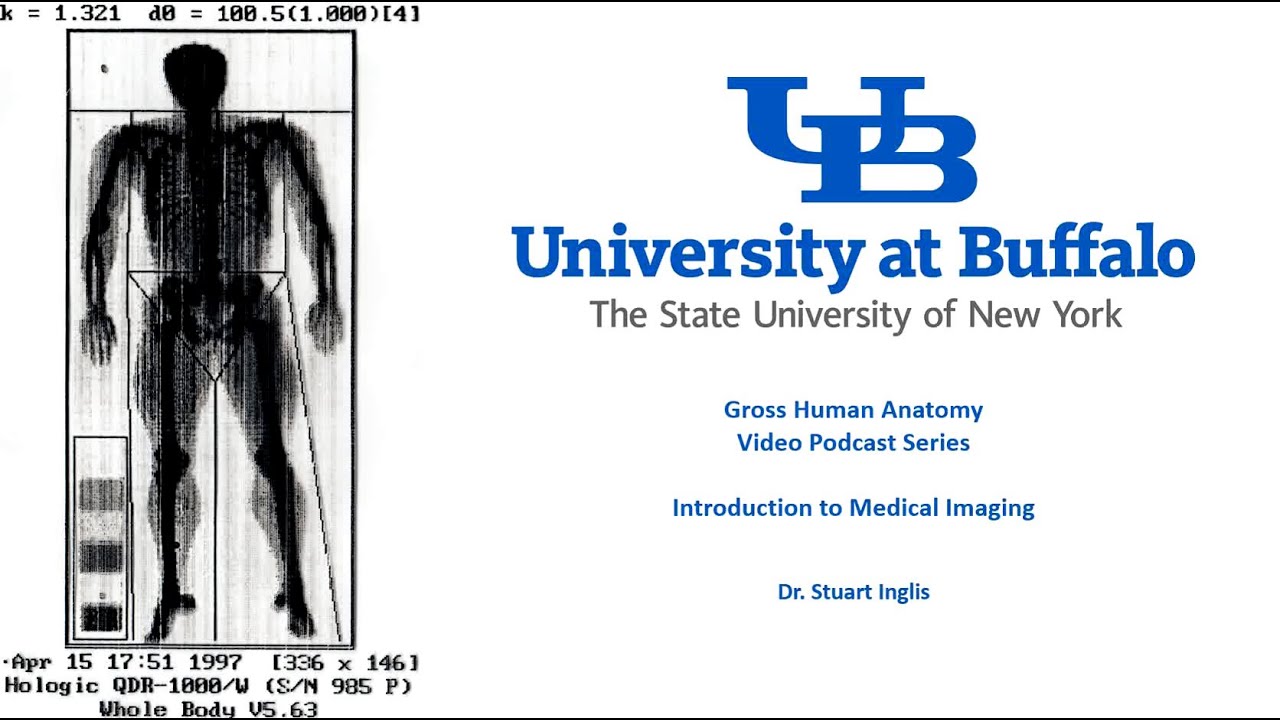 Introduction To Medical Imaging Youtube