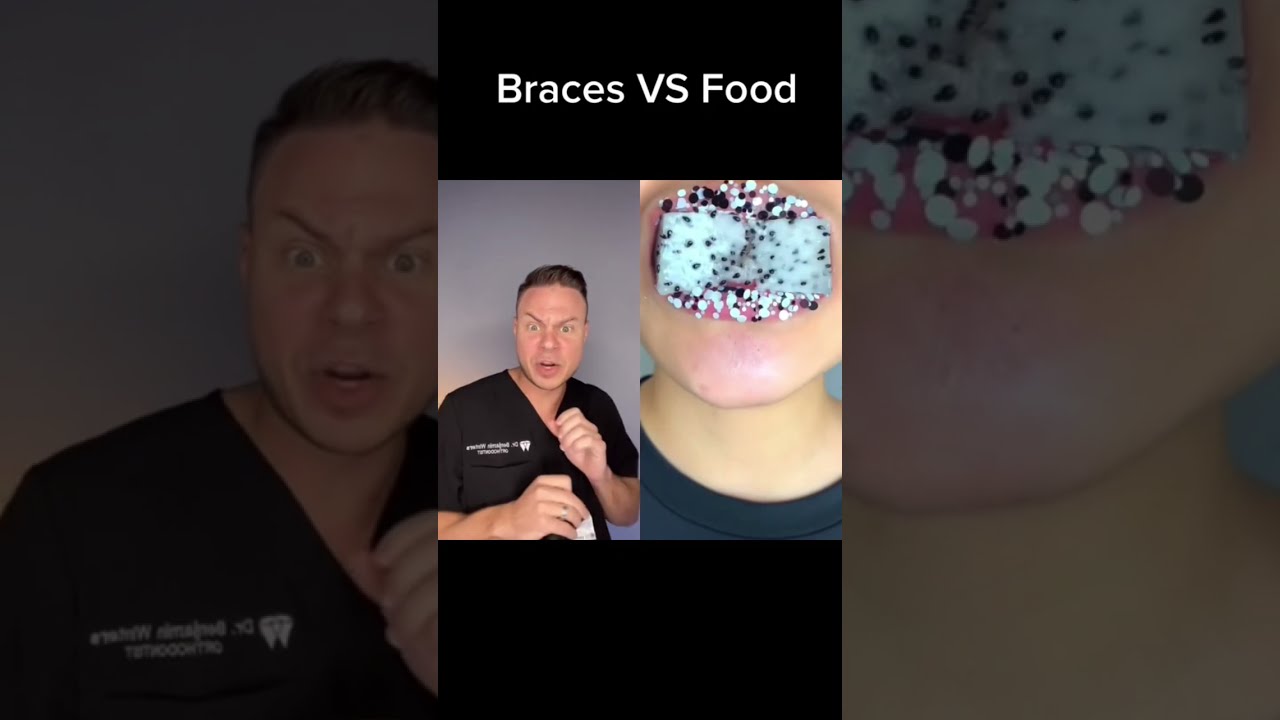 Braces Vs Food Asmr Youtube