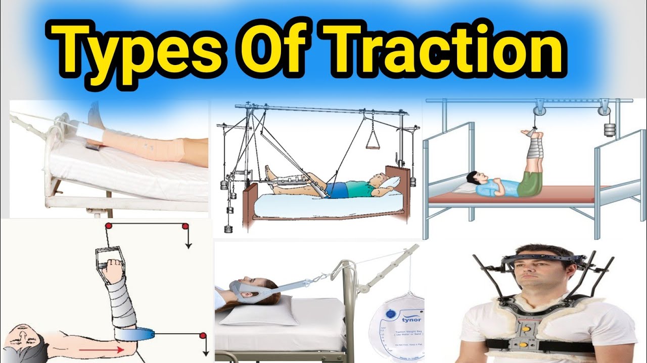 Skeletal Traction Device At Mai Lowder Blog