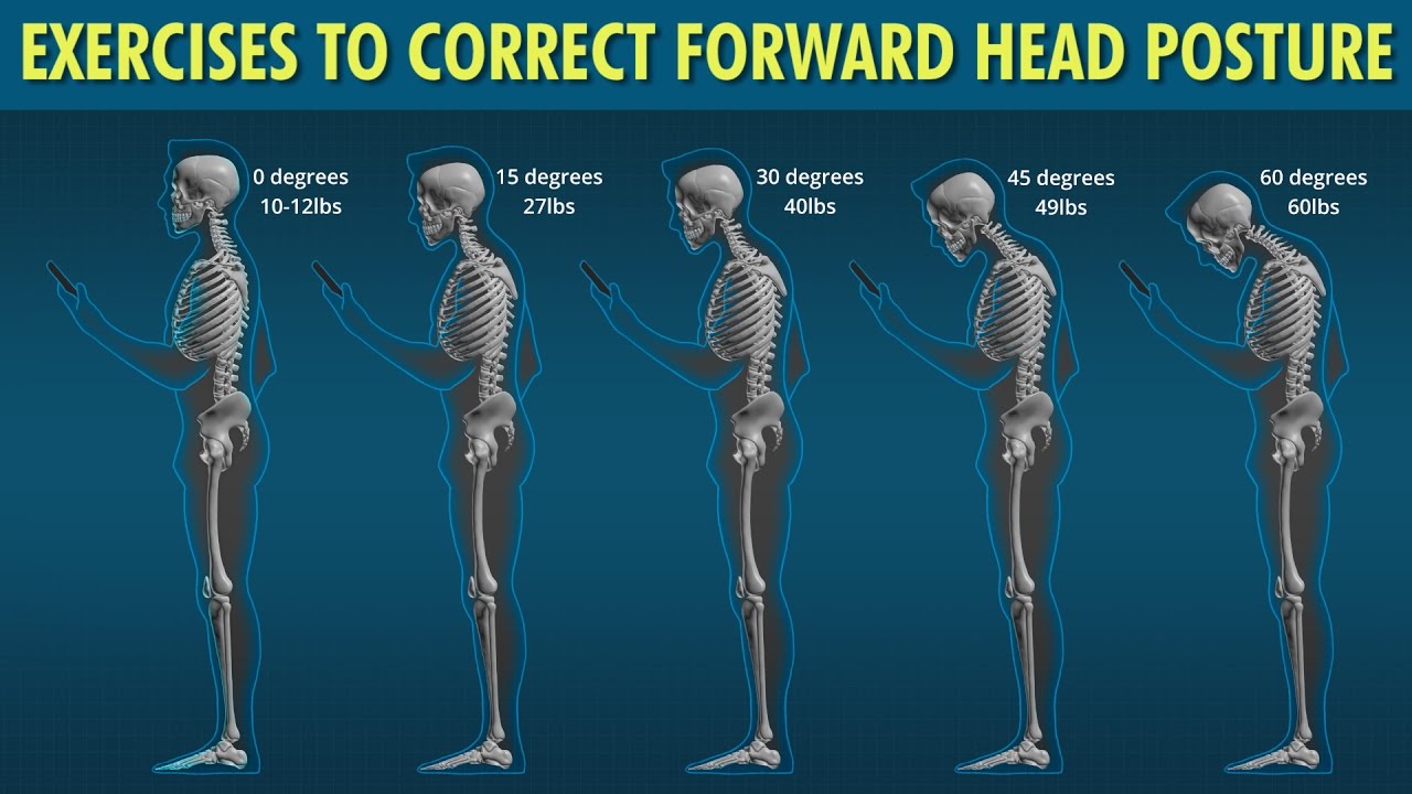 Forward Head Exercises To Correct Posture Youtube