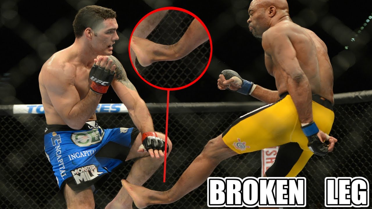 Anderson Silva Horrible Broken Leg Injury At Ufc 237 Youtube