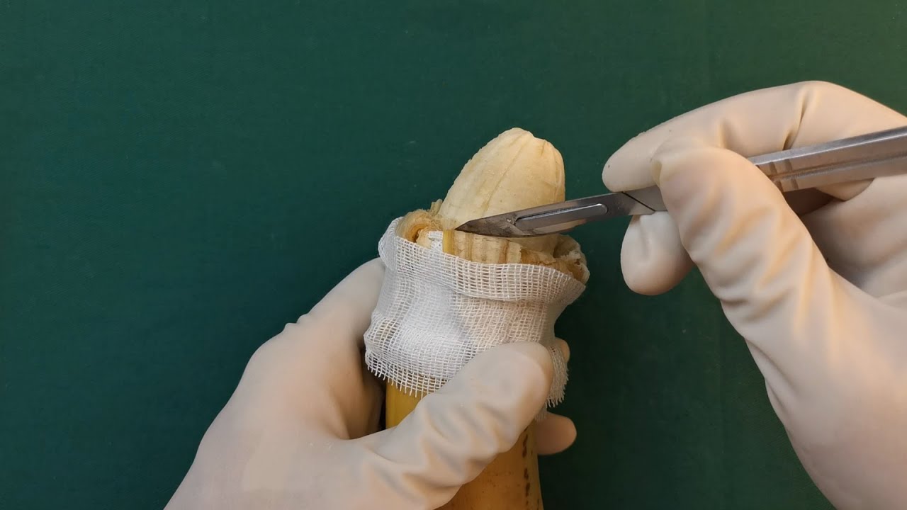 Circumcision Surgery Youtube