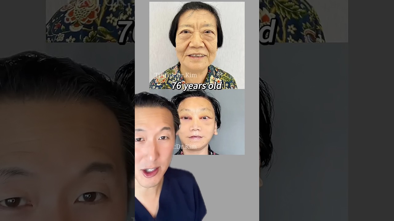 Plastic Surgeon Or Menace Tiktok S Dr Kim Results Cambridge Breast
