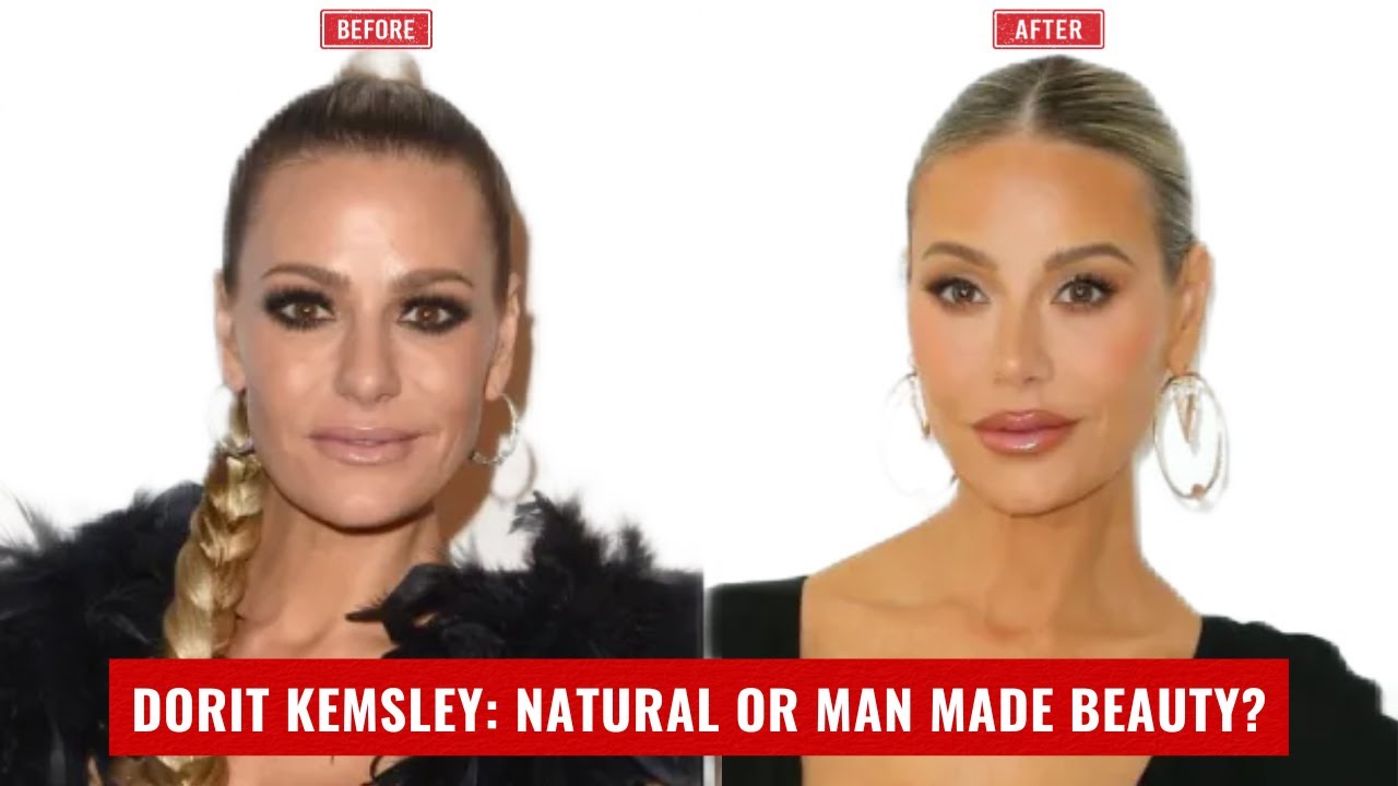 Dorit Kemsley Plastic Surgery Analysis Natural Or Man Made Beauty