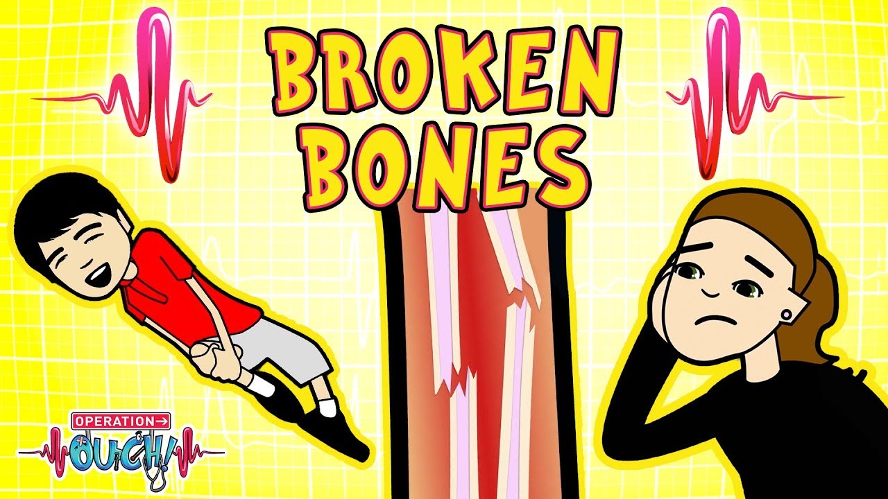 Science For Kids Body Parts Broken Bones Experiments For Kids