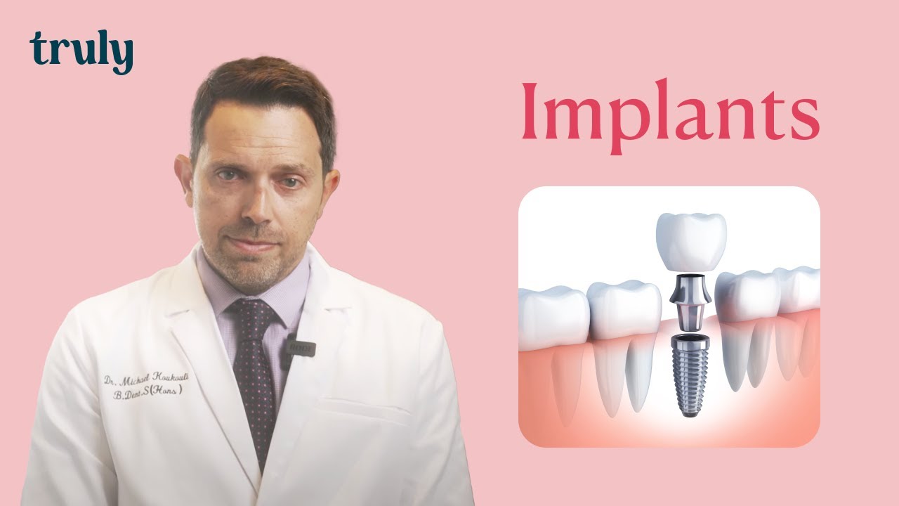 Implants Q A With Dr Michael Youtube