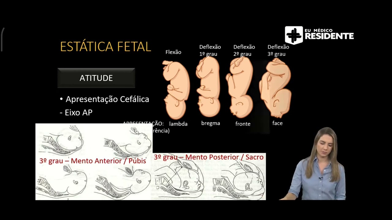 Cai No Revalida Inep 2023 2 Estática Fetal Youtube