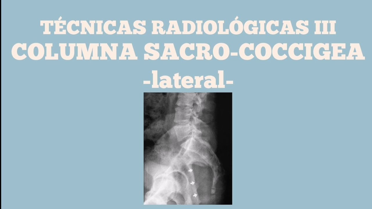 Radiografia Lateral Do Coccix
