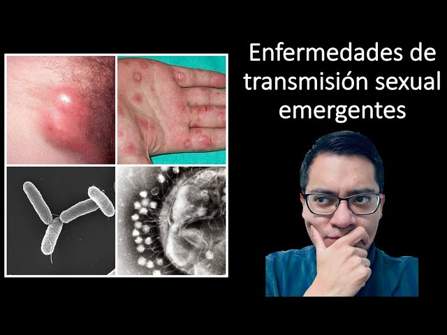 Enfermedades De Transmision Sexualidad
