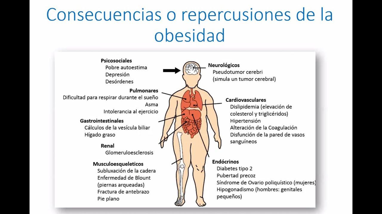 Obesidad Enfermedad Socialmente Contagiosa Youtube