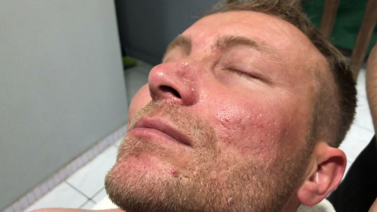 Asmr Relaxing Detailed Skin Care Part 1 Youtube