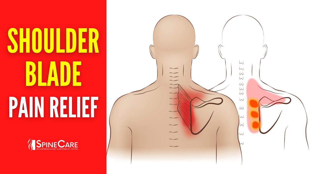 Rhomboid Pain Interscapular Pain What Is It And How To Fix 60 Off
