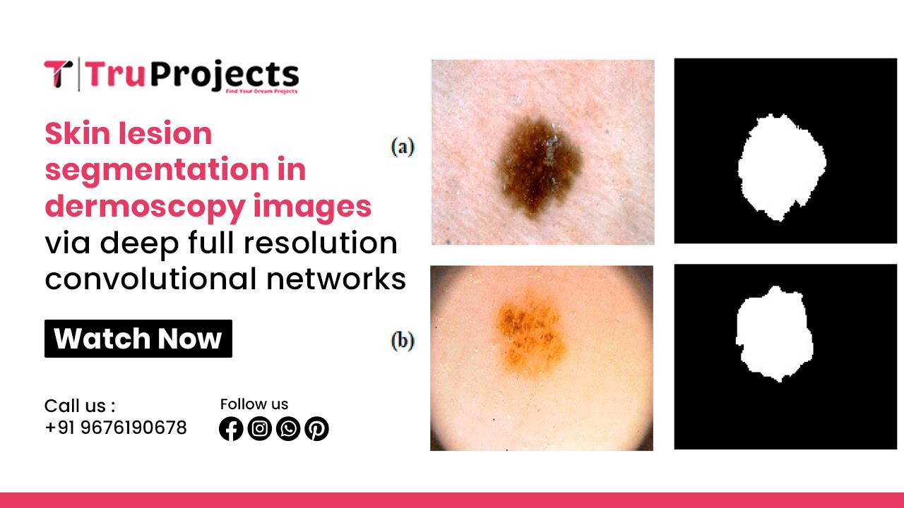 Skin Lesion Segmentation In Dermoscopy Images Via Deep Full Resolution