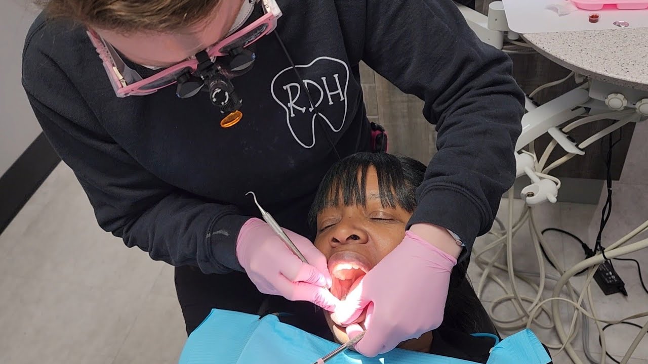Full Dental Teeth Cleaning S3 E8 Youtube