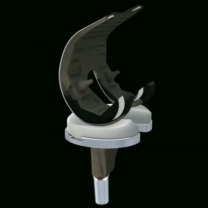 Knee Joint Medico Kneejoint Anatomy Youtube
