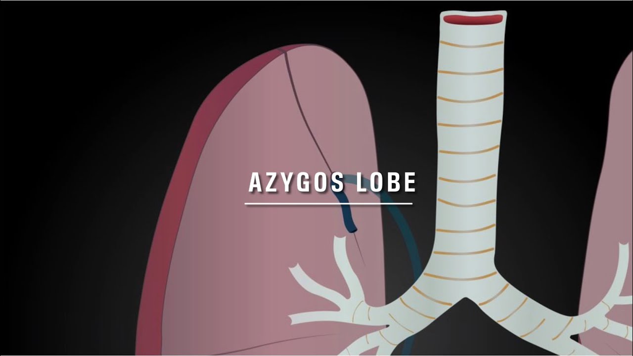 Azygos Lobe Notes Youtube