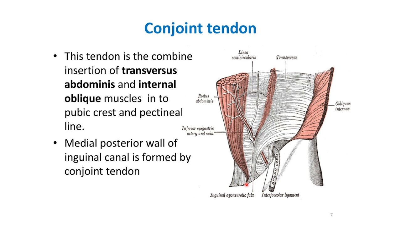 Conjoined Tendon Free Functional Gracilis Transfer For Reconstruction