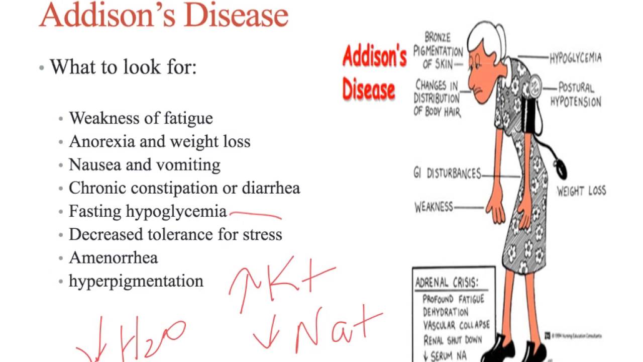 10 Signs Of Adrenal Dysfunction