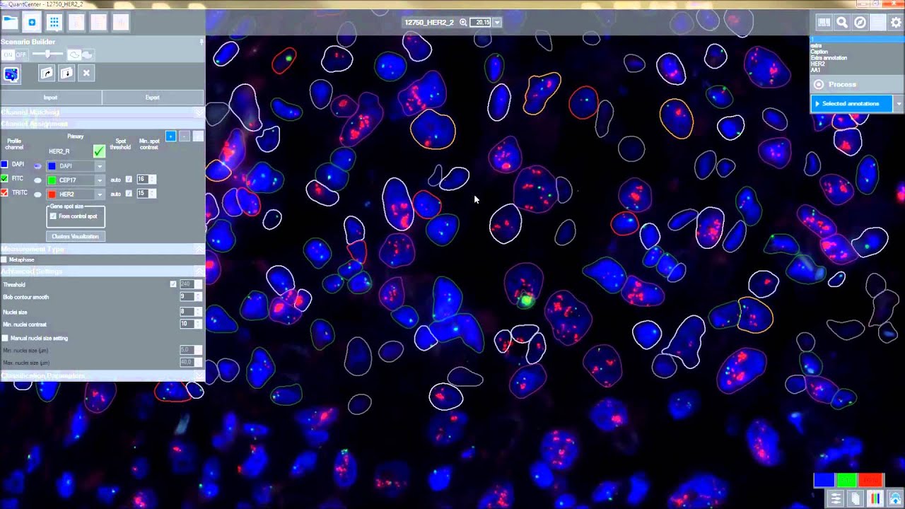 3dhistech Fishquant Module Youtube