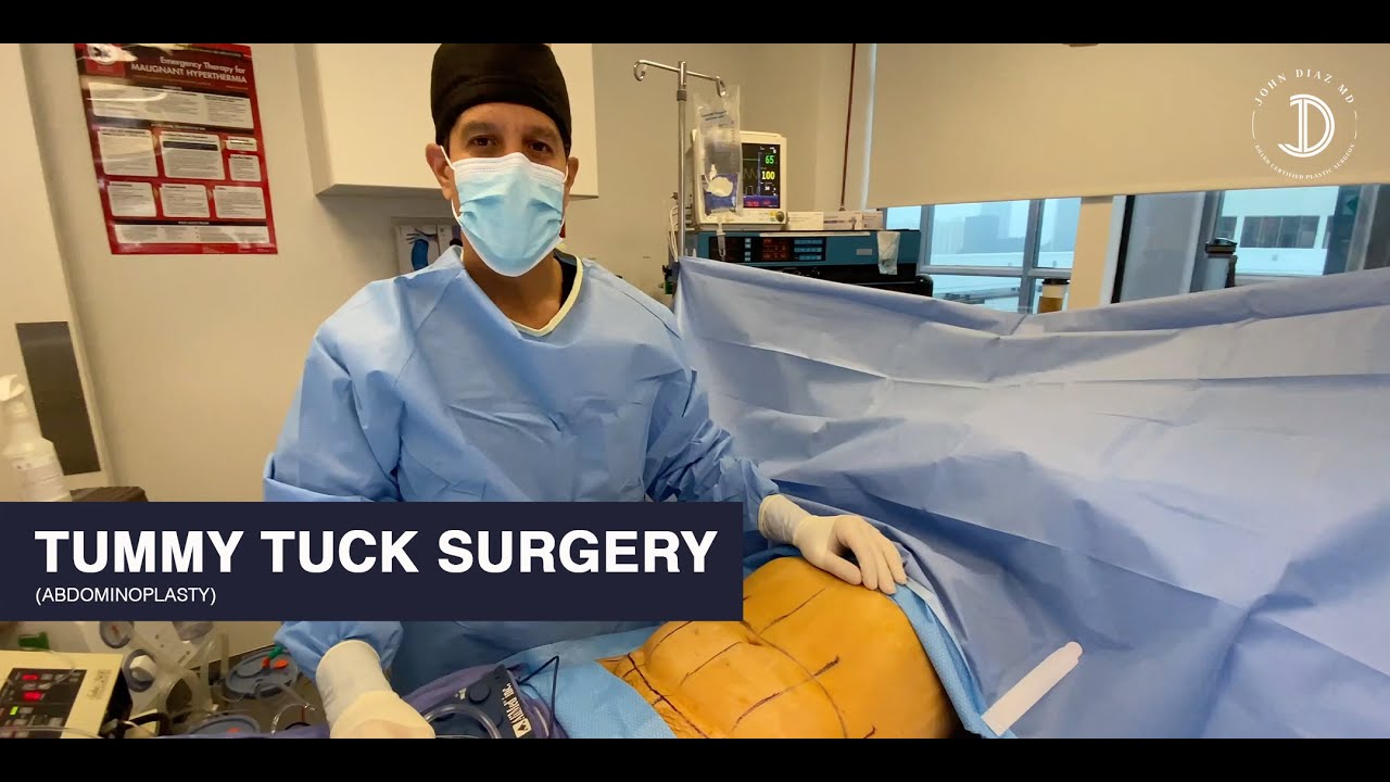 Tummy Tuck Surgery Abdominoplasty Youtube