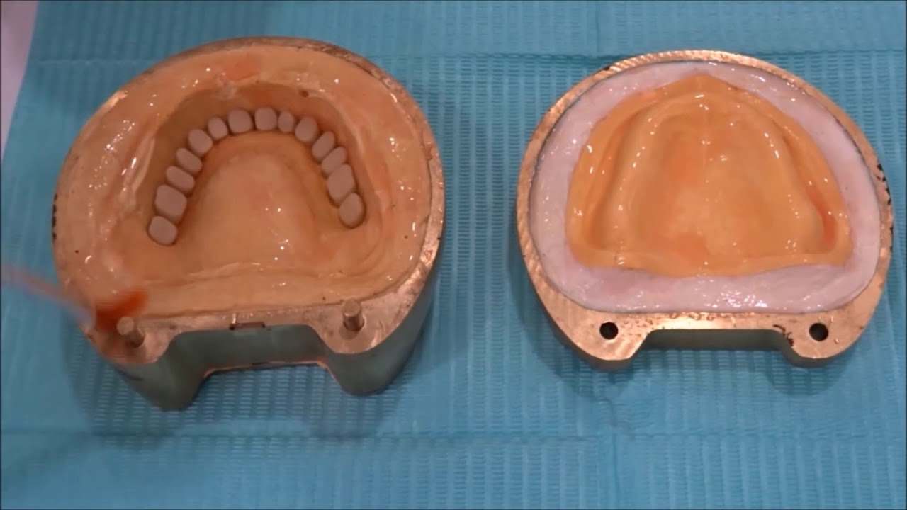Full Denture Process At Kevin Blankenship Blog