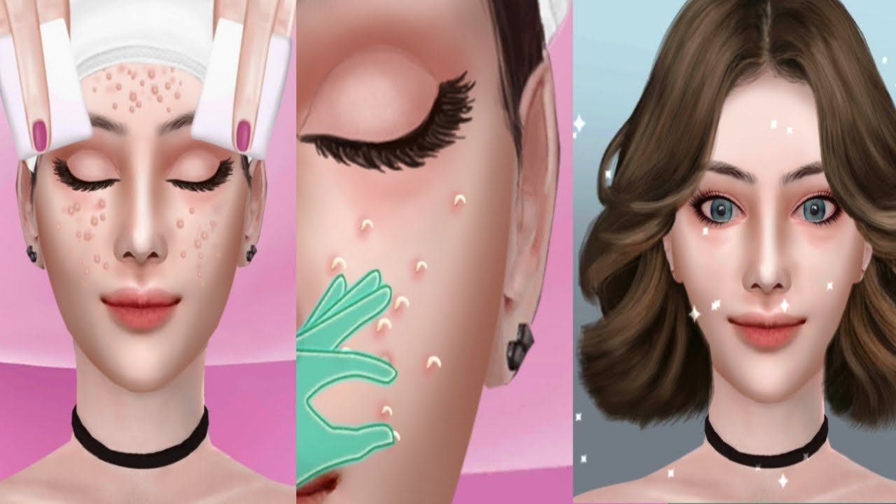 Asmr Acne Big Blackhead Removal Animation Pimple Removal Youtube