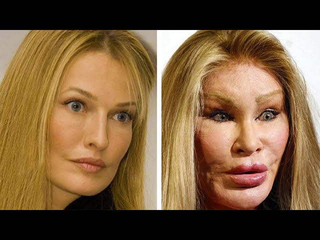 My Strange Addiction Plastic Surgery