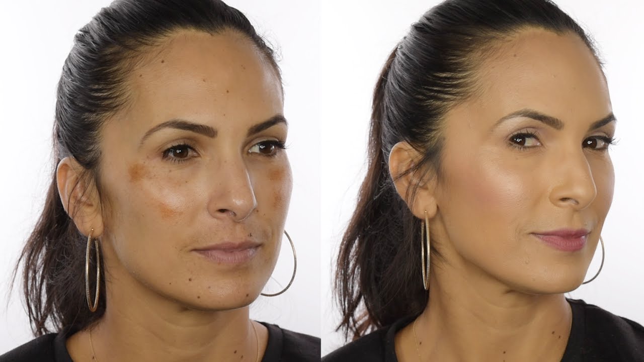 Makeup Tips For Melasma Makeup Vidalondon
