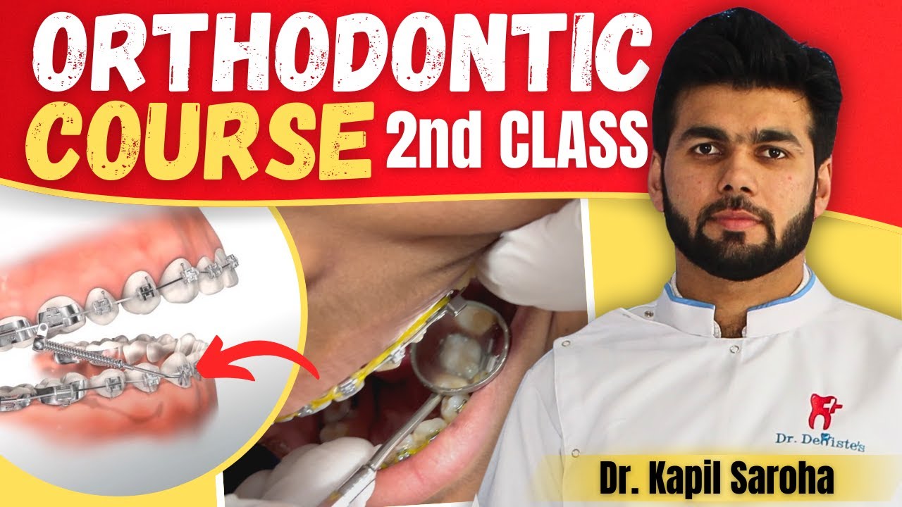 Orthodontic Course Class 2 Forces Appliances By Dr Kapil Saroha
