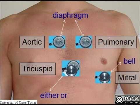 Auscultation Of Heart Sounds Youtube