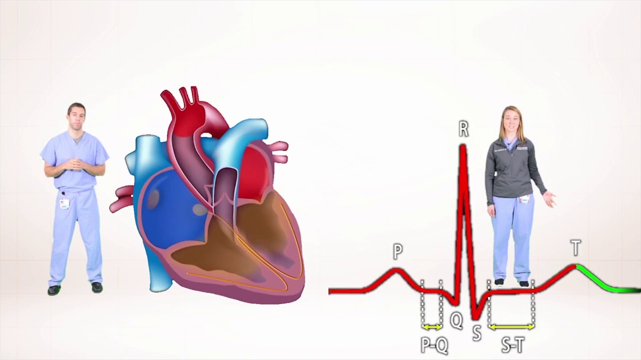 Ecg Waveform Explained Ekg Labeled Diagrams And Components 47 Off