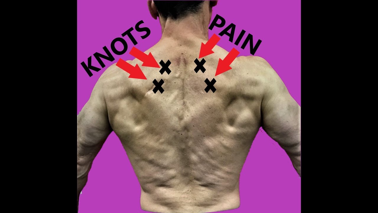 Rhomboid Pain Relief