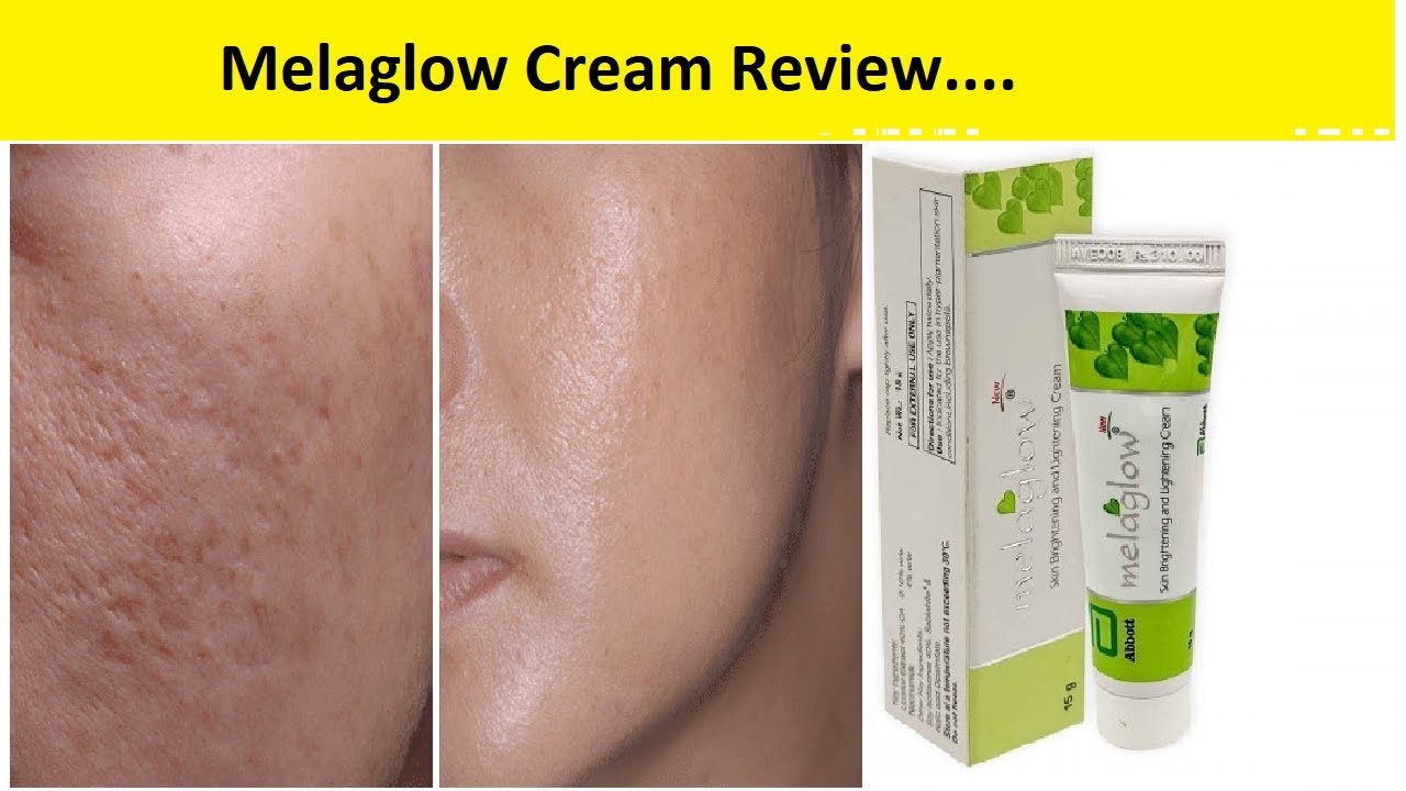 Melaglow Cream Review Uses Side Composition Face And Body