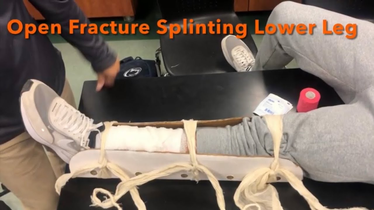 Open Fracture Splinting Lower Leg Youtube