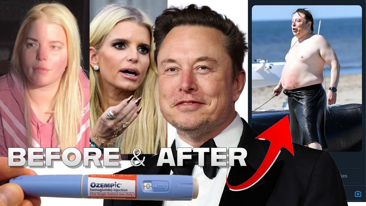 Celebrities Ozempic Face 60 Photos Moonagedaydream Film