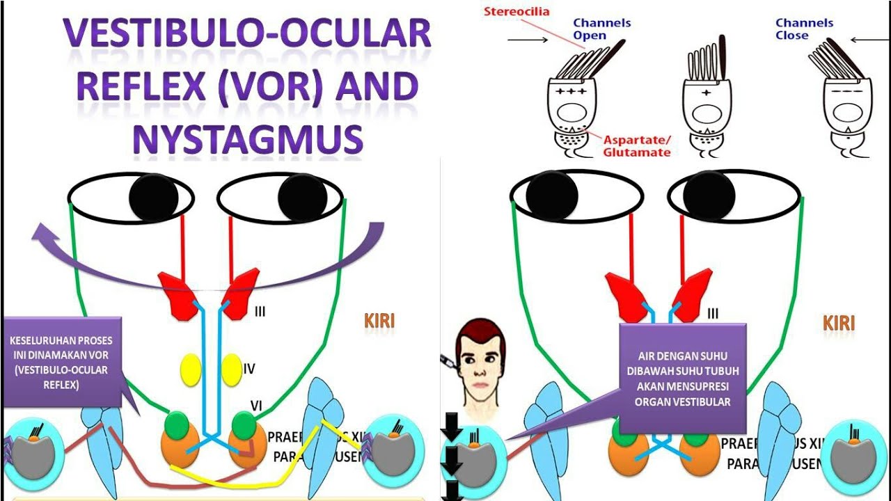 Example Of Vestibulo Ocular Reflex