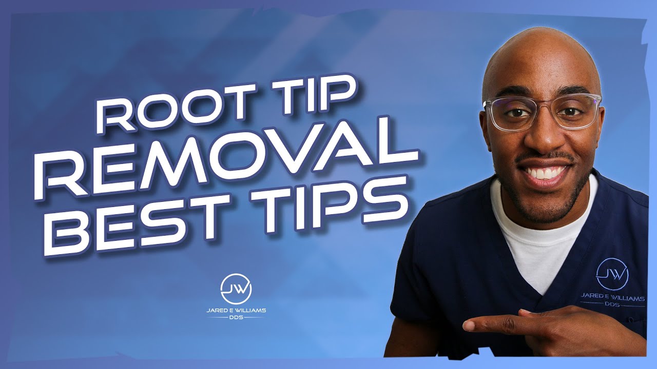 How To Remove A Root Tip Best Tips Youtube