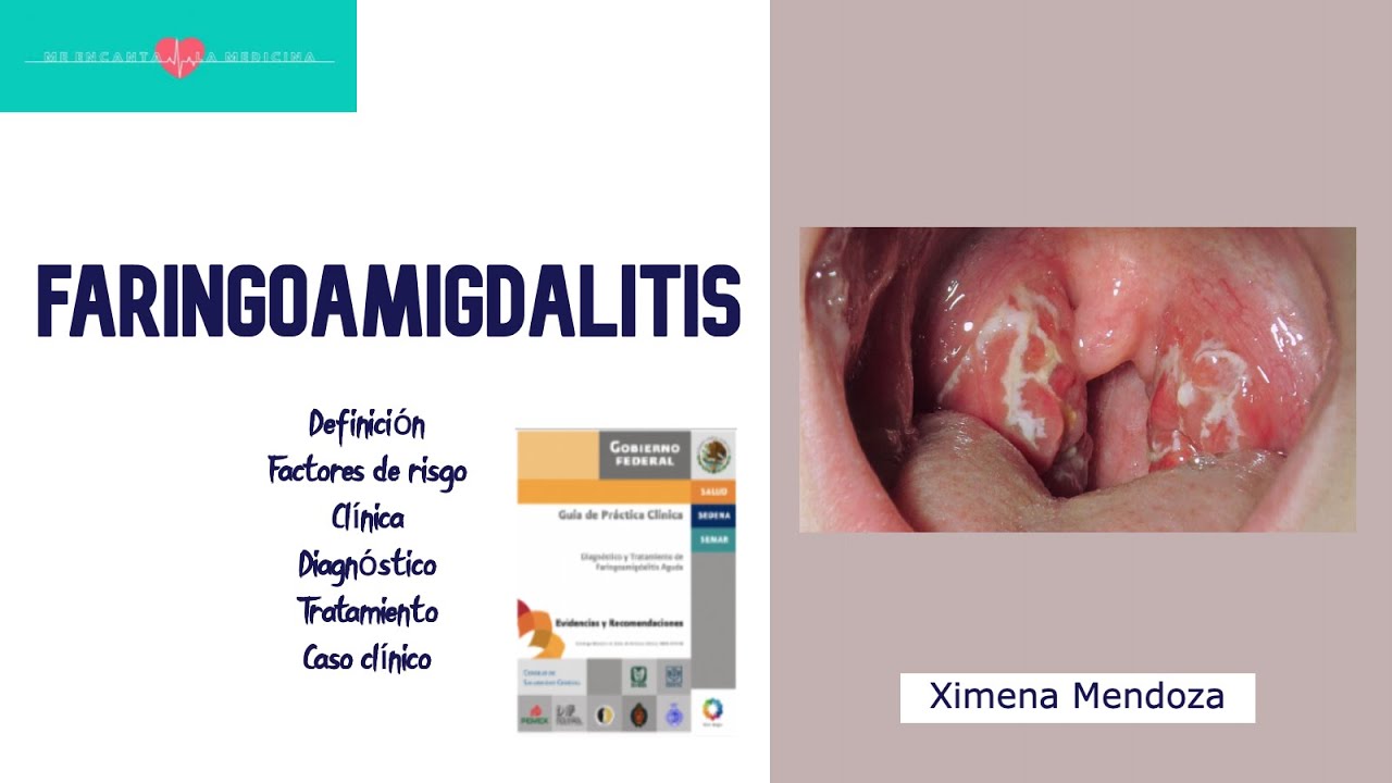 Faringitis Bacteriana Síntomas Y Tratamiento Vsmnk