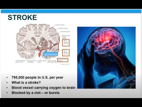 Decoding Stroke Part 1 An Introduction To Stroke Youtube