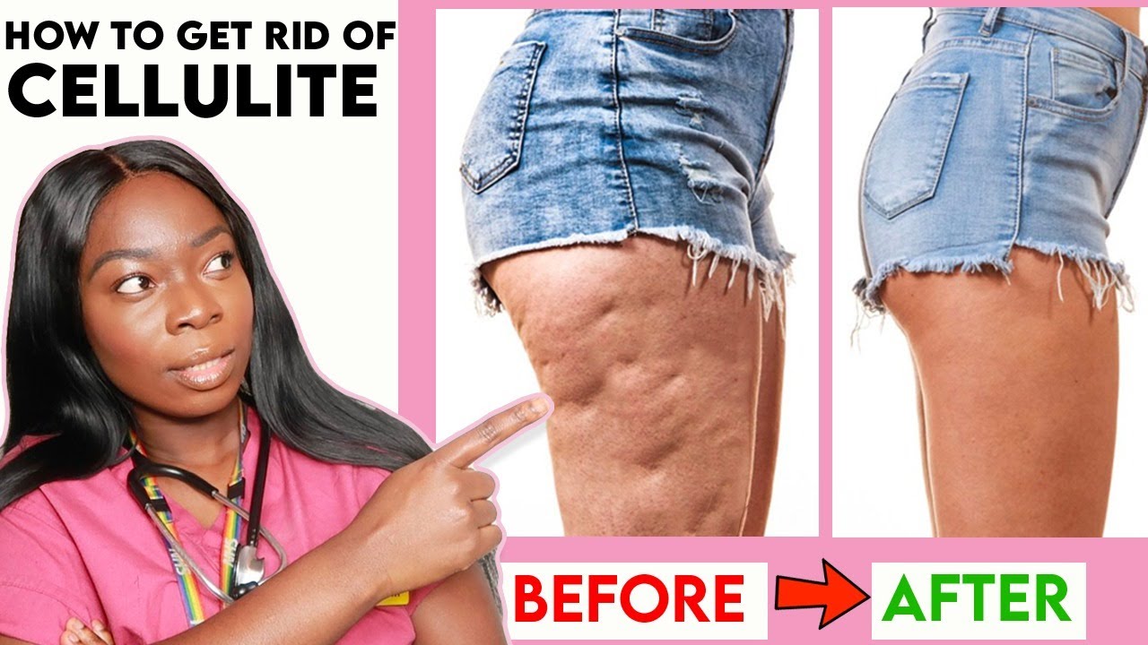 How To Get Rid Of Cellulite On Your Thighs Legs Butt Home Remedies