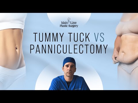 How Can Health Insurance Cover My Panniculectomy Surgery