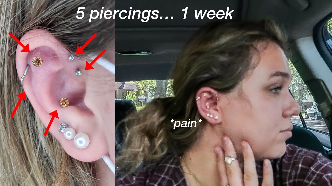 What Is A Flat Helix At Belinda Baker Blog