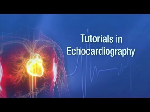 Echo Tutorials Mayo Clinic Youtube