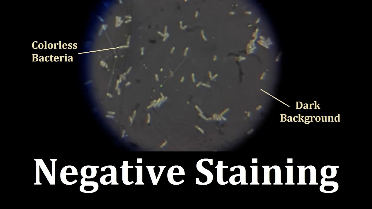 Negative Stain