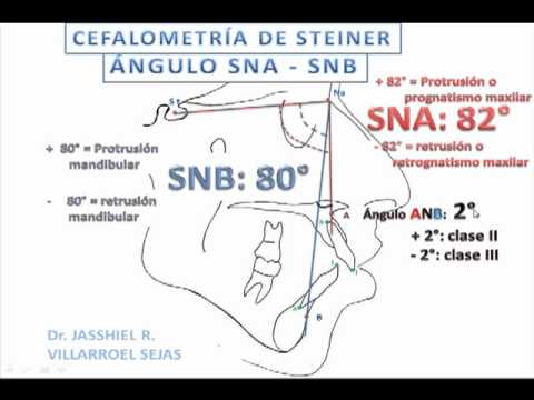 Análisis Estético De Steiner Clave En Ortodoncia Botoxina