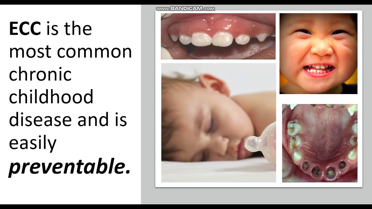 Ecc Youtube