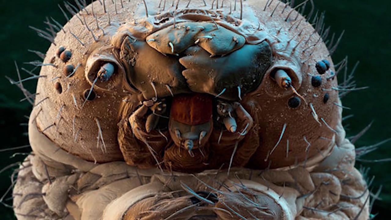 Demodex Mites