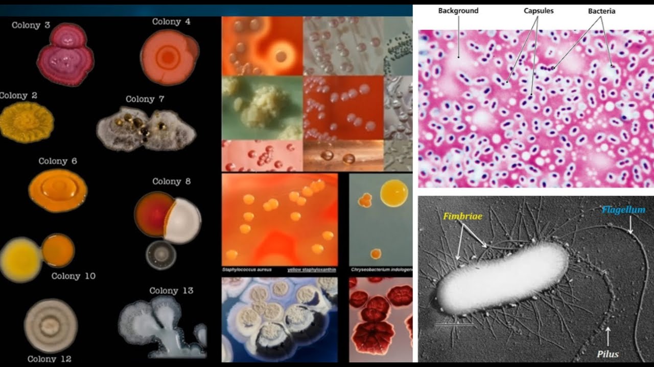 Sample Processing In Microbiology Lab At Piper Flierl Blog